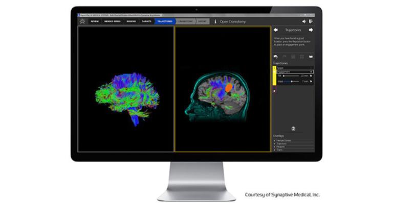 Synaptive Medical cerne un problème et le résout